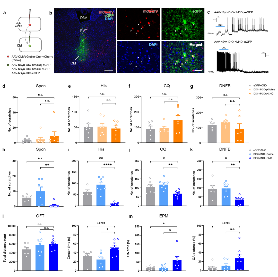 Nat Commun：空医大李云庆/董玉琳团队报道痒及相关焦虑样行为的新神经环路机制__财经头条