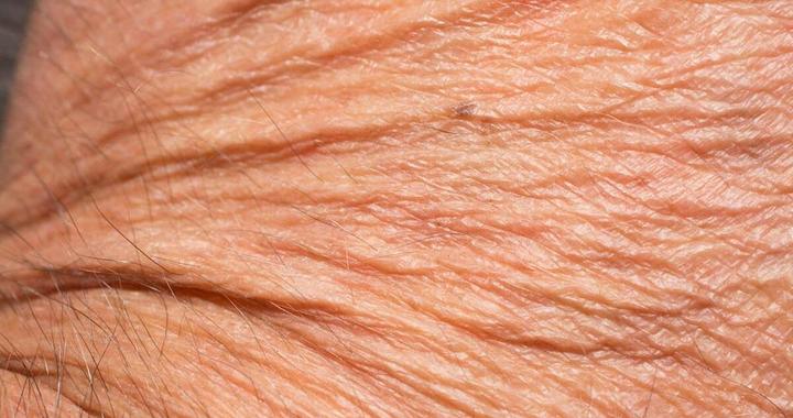 进入老年期，肌肉流失得很快！若不想老了干瘪，有什么办法挽救？|老年人|疾病|有氧运动_新浪新闻