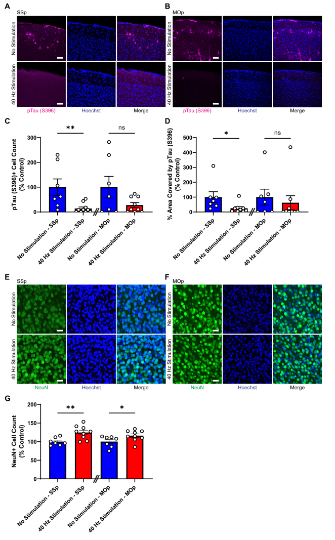MIT蔡立慧团队最新报道40Hz震动刺激改善AD病理和运动表现__财经头条