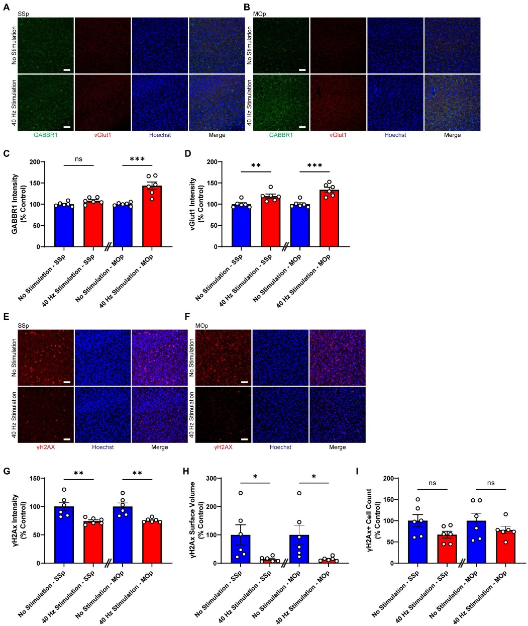 MIT蔡立慧团队最新报道40Hz震动刺激改善AD病理和运动表现__财经头条
