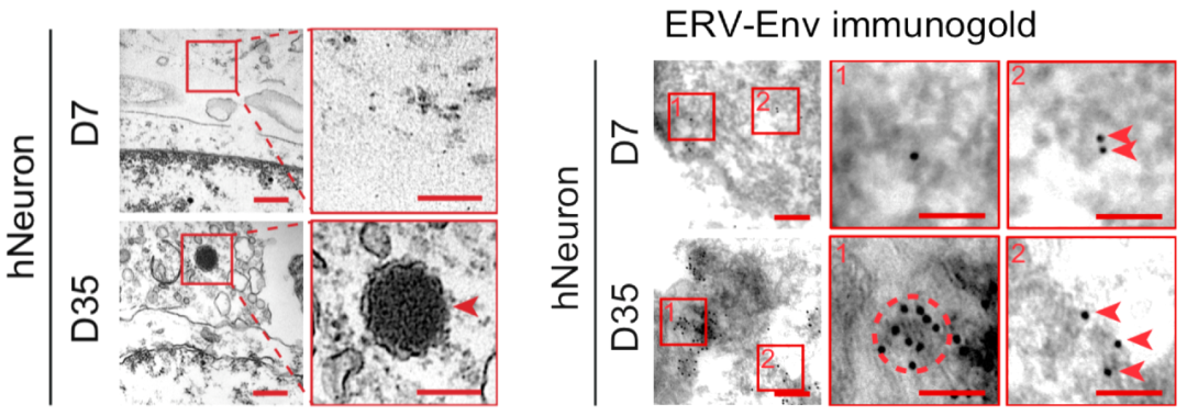 Cell子刊：刘光慧/张维绮/曲静/王思等揭示驱动程序性脑衰老新机制__财经头条