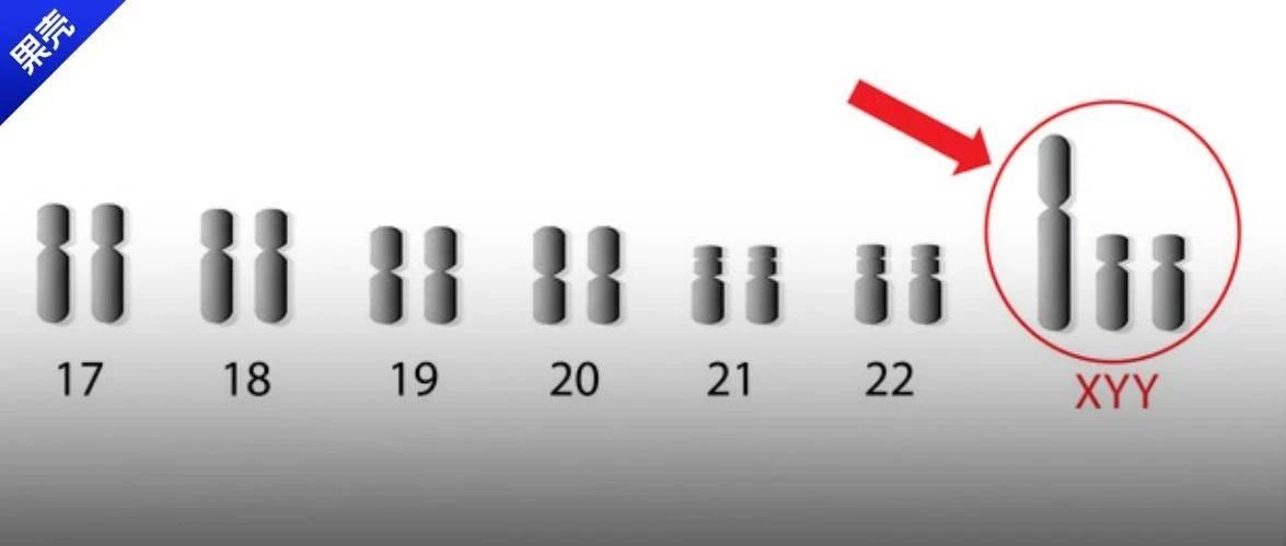 XYY基因的都是暴力狂？其实XYY比想象中更常见|暴力|染色体|综合征_新浪新闻