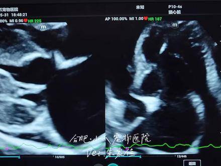 猫HOCM(肥厚型梗阻性心肌病) 非常典型的SAM征象(二尖瓣收缩期前向运动)|猫|宠物医院_新浪新闻