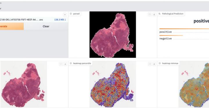 LG AI Research使用亚马逊云科技开发AI模型 加快癌症诊断速度|LG|AI|亚马逊_新浪新闻
