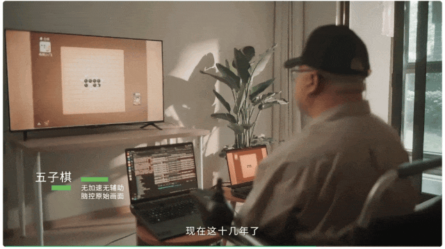 比马斯克Neuralink工艺更先进！我国成功开展首例侵入式脑机接口临床试验_创事记_新浪科技_新浪网