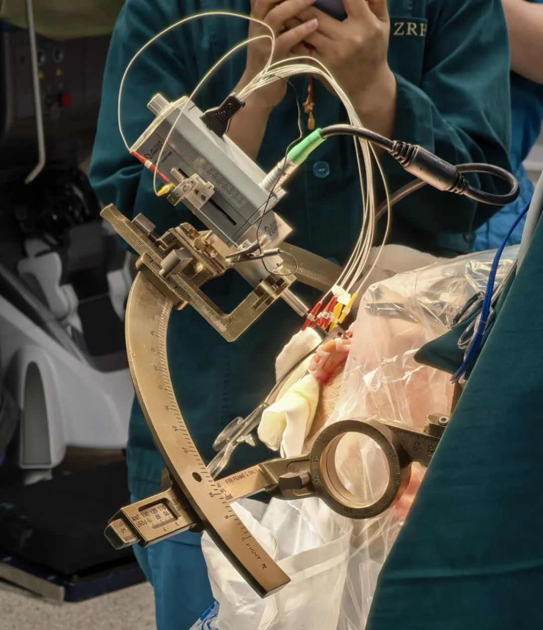 王晓松主任专家民航总医院首例“脑深部电刺激器植入术”成功开展|民航|刺激器|医院