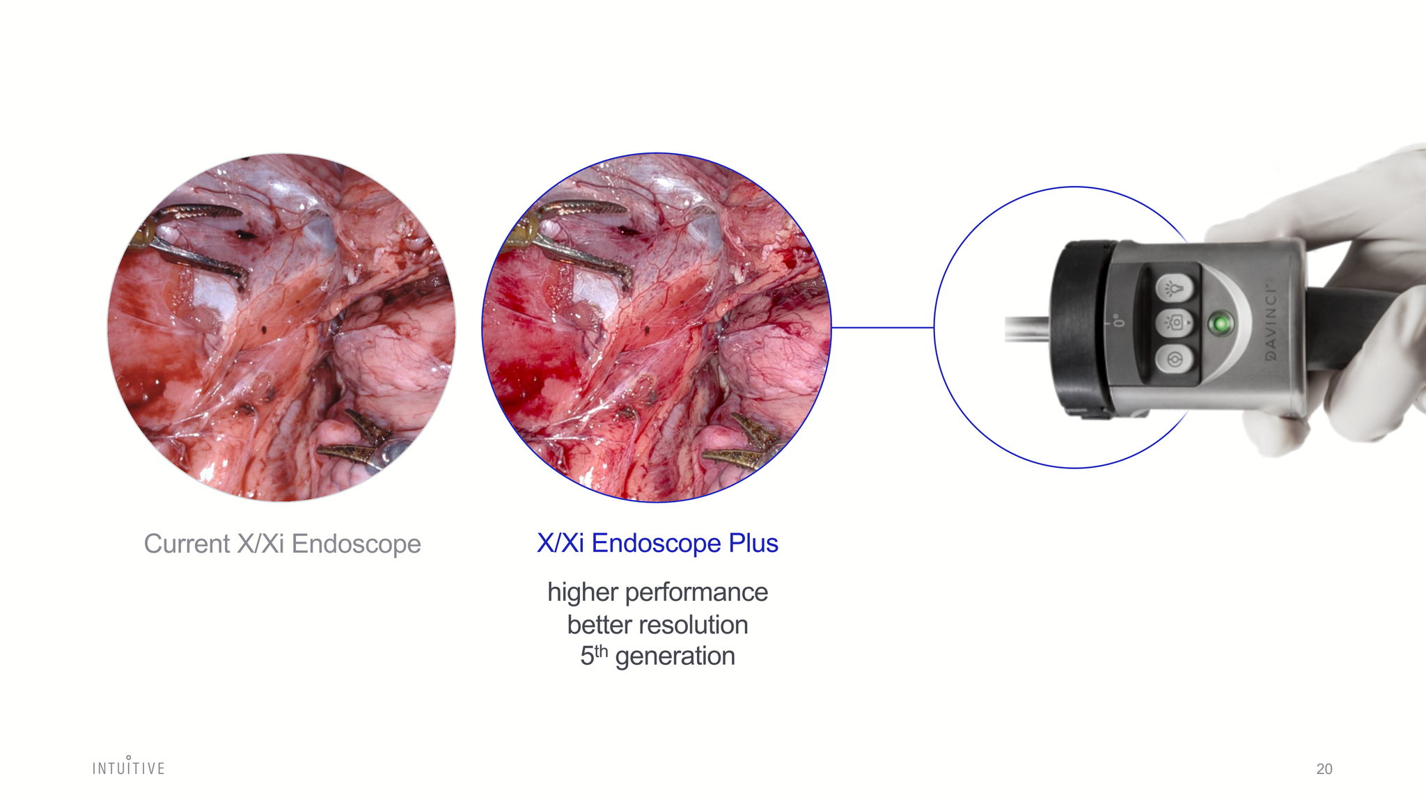 ISRG：2019年全球最大的机器人手术公司营收高达45亿美元|机器人_新浪科技_新浪网