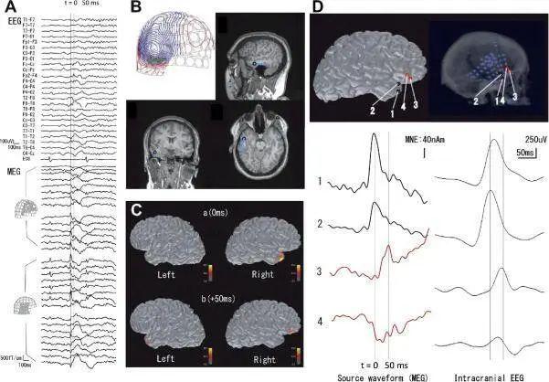 行业｜脑磁图：探索生命禁区的新星|磁场|SQUID_新浪新闻