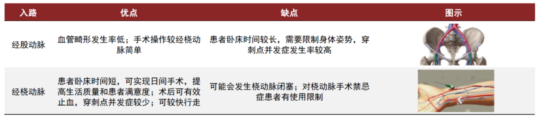 中金 | 肾神经阻断疗法：临床研究峰回路转，介入治疗高血压前景可期_手机新浪网