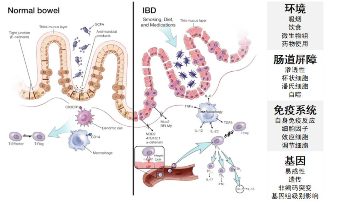中金 | 创新药前沿系列—— 炎症性肠病（IBD）：生物制剂突显长期缓解优势_新浪财经_新浪网