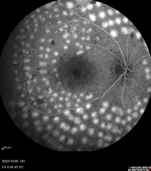 合肥普瑞再添“黑科技”海德堡 Spectralis HRA 共焦激光同步血管造影系统|血管|眼科_新浪新闻