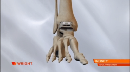 学科精细化促骨科发展迈入新时代_手机新浪网