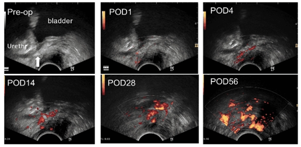 韬睿生物|Celution系统获日本厚生劳动省上市批准治疗男性压力尿失禁|日本_新浪新闻