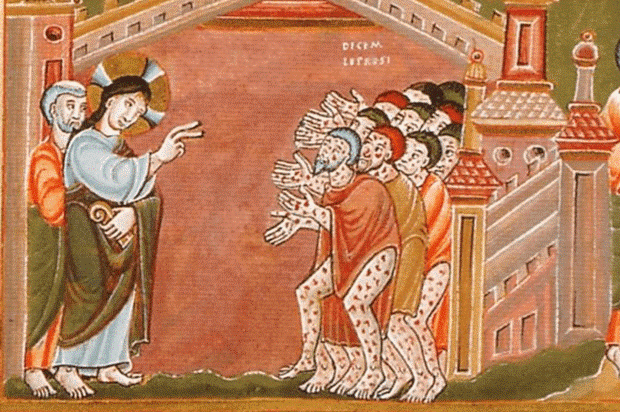 面容扭曲、肢端残废，禁锢在孤岛，是他们以前难逃的宿命_手机新浪网