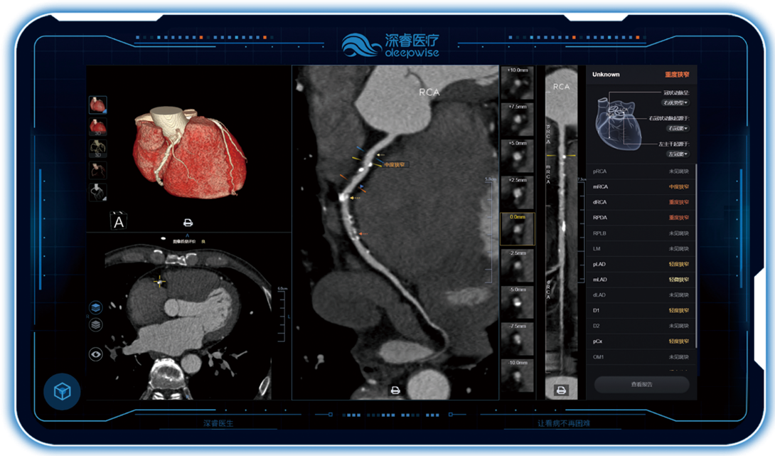 第七证 | 深睿医疗冠脉AI产品获NMPA三类证_手机新浪网
