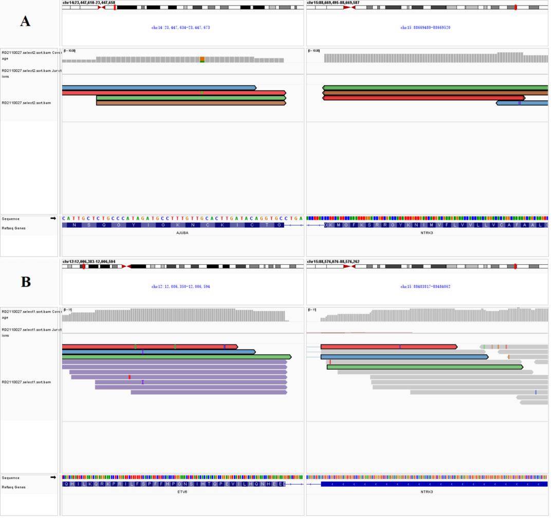 全球首例！迪安诊断NGS平台助力发现甲状腺癌新型罕见NTRK3双融合|基因_新浪财经_新浪网
