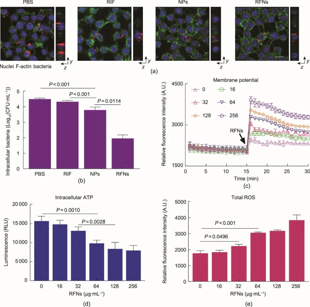 用于精准和响应性治疗胞质耐药菌的刚性药物递送系统丨Engineering|美国_新浪财经_新浪网