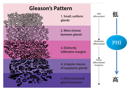 【兰卫科普】前列腺特异性抗原同源异构体p2PSA测定|前列腺癌_新浪财经_新浪网