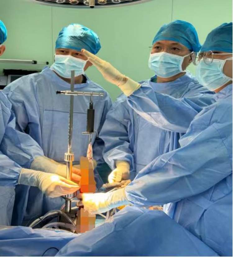 21岁女大学生手腕骨折！微创治疗仅留下3个针眼，未留手术疤痕_新浪财经_新浪网