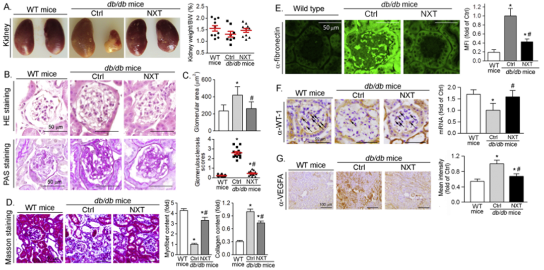 脑心通对db/db进展性小鼠糖尿病肾病的治疗潜力|糖尿病_新浪财经_新浪网