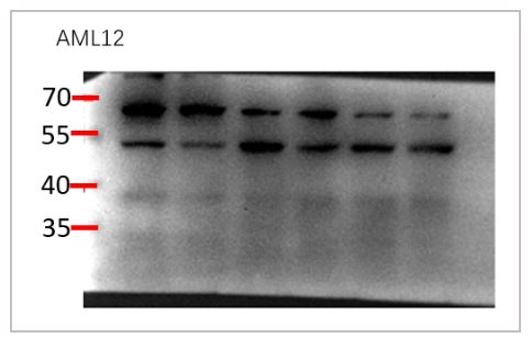 【小优细节君】焦亡研究之GSDMD检测经验分享|文献_新浪财经_新浪网