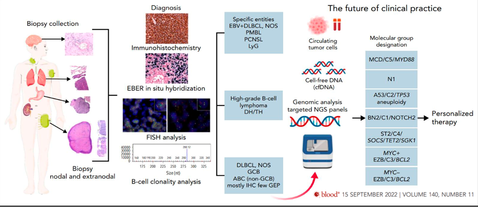 Atypical pattern in FISH ｜我们正致力于解读不典型信号（淋巴瘤篇-1）|文献_新浪财经_新浪网