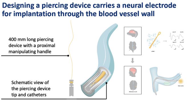 科学家研发新型介入式脑机接口，免开颅即可植入超柔性电极，已成功采集到高质量神经信号|绵羊_新浪财经_新浪网