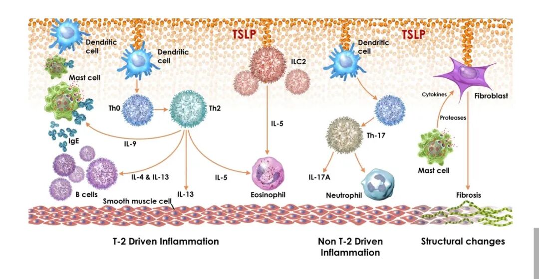 Upstream大涨18%！长效TSLP抗体CRSwNP二期临床成功，欲挑战Sanofi和AZ_新浪财经_新浪网