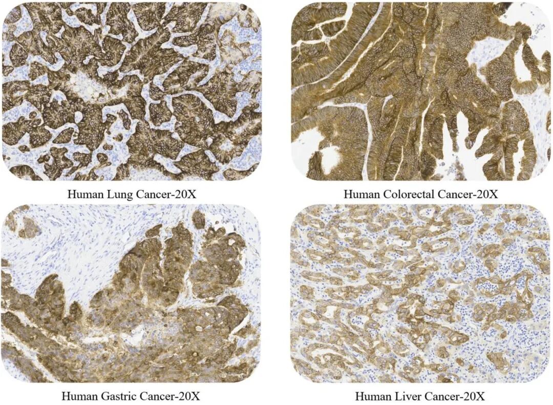 高性能C-MET IHC 抗体助力 C-MET 靶向 ADC药物开发|肿瘤_新浪财经_新浪网