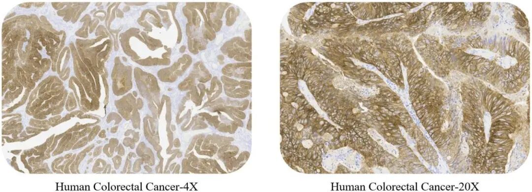 高性能C-MET IHC 抗体助力 C-MET 靶向 ADC药物开发|肿瘤_新浪财经_新浪网