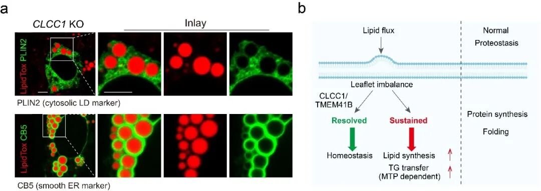 Nature | 北京大学郭强与合作者发现内质网蛋白CLCC1感应膜平衡并控制脂流向|北京大学_新浪财经_新浪网