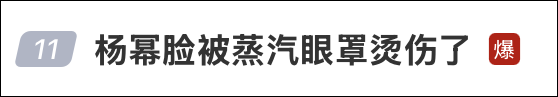 杨幂脸部遭烫伤！网友后怕：“我每次都是戴着睡觉，再也不敢了 ……”|烫伤_新浪财经_新浪网