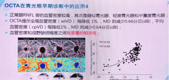 爱尔医学速递| 高分辨“OCT、OCTA”可为青光眼诊断筛查带来哪些经验体验？_手机新浪陕西_新浪网
