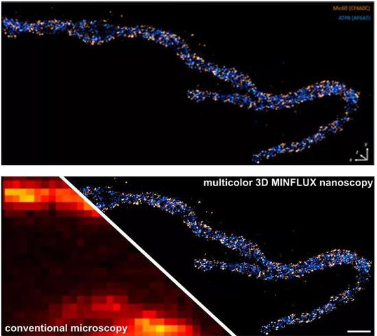 看见病毒：显微镜的百年历程|显微镜|病毒_新浪科技_新浪网