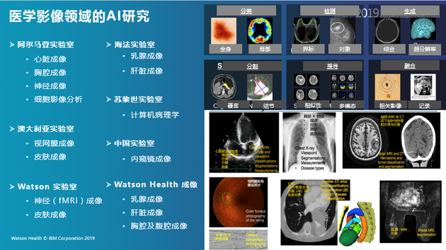 IBM Watson Health亮相2019全球人工智能健康峰会|Watson|人工智能_新浪科技_新浪网