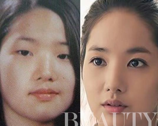 “整容最厉害”的韩国女星 朴敏英终成大美女|朴敏英|整容_新浪时尚_新浪网