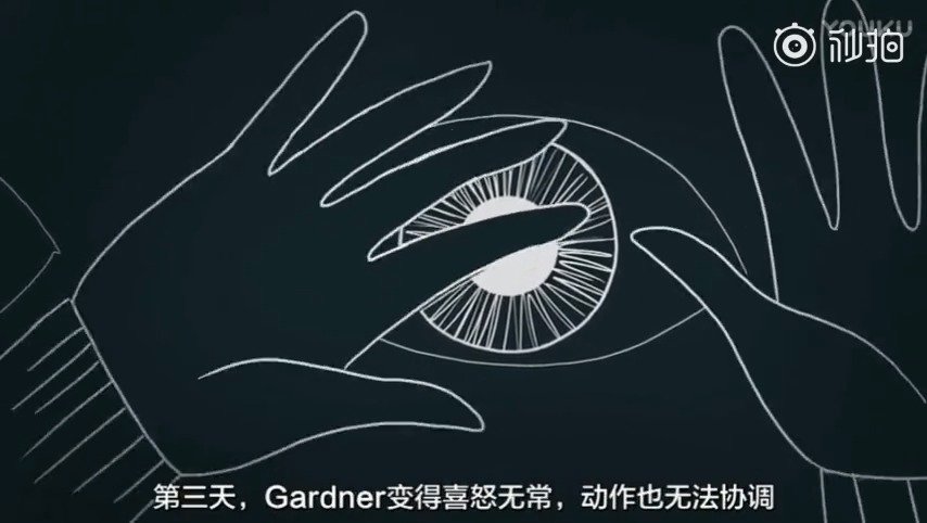 TED动画短片《人不睡觉会怎样》_新浪新闻