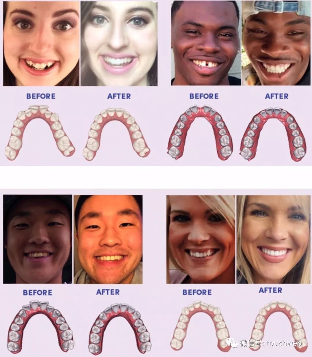 SmileDirectClub上市:募资超13亿美元 成今年前五IPO|IPO_新浪财经_新浪网