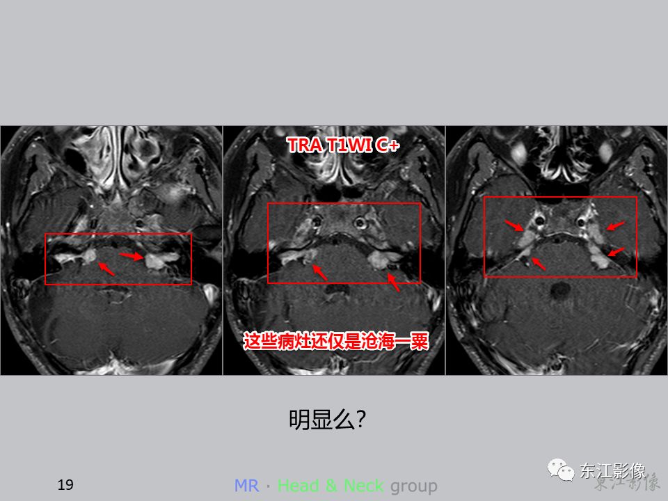 【病例分享】这些案例告诉影像科医生，这样做能大大减少漏诊误诊率|漏诊|影像|医生_新浪新闻